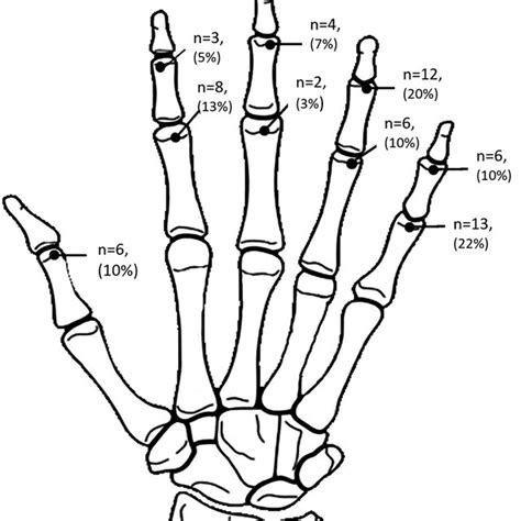 Fracture Locations Distribution Download Scientific Diagram