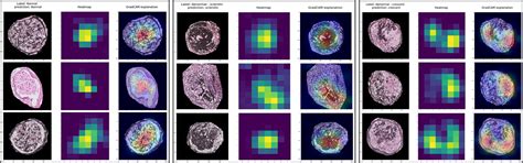 explainability of a deep learning based classification model for