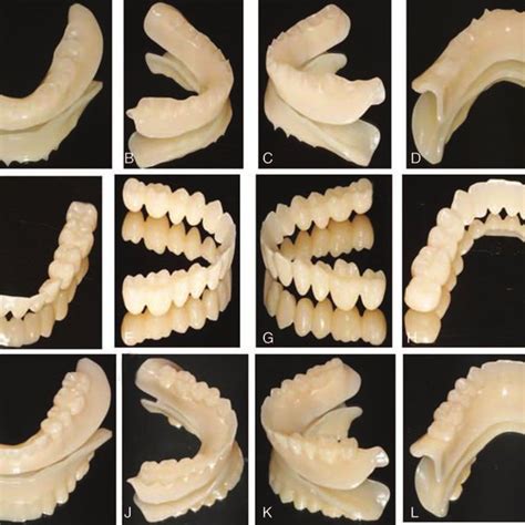 The Flowchart For Designing And Fabricating Complete Dentures Via