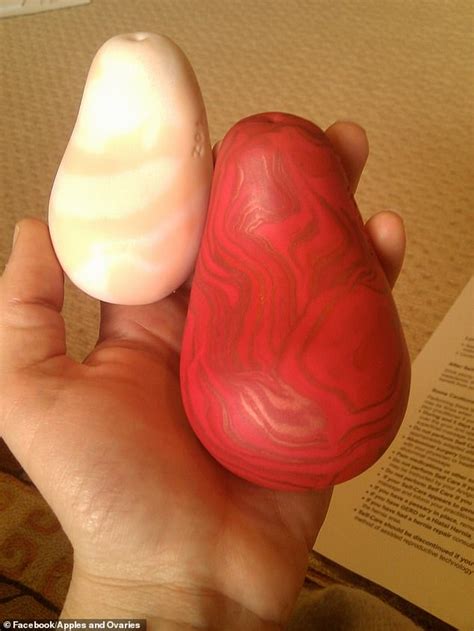 Shocking Photo Shows How A Uterus DOUBLES In Size When You Re Menstruating Daily Mail Online