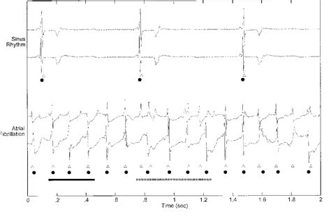 Figure 1 From A High Temporal Resolution Algorithm For Quantifying