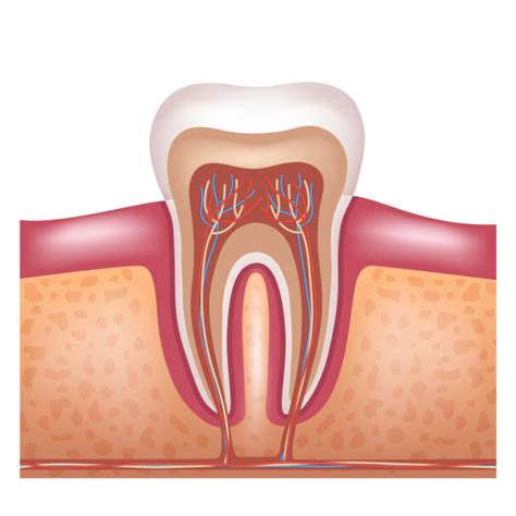 Exposed Tooth Nerve Picture