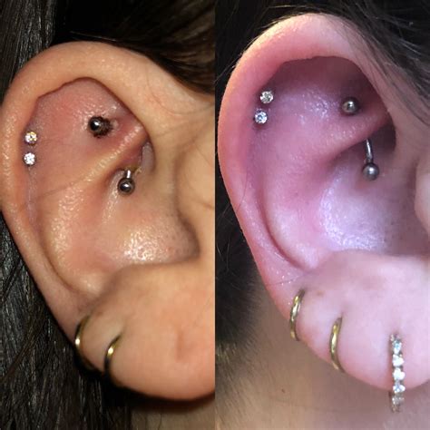 Not 100 Percent Healed Yet But Come A Long Way With My Rook Left