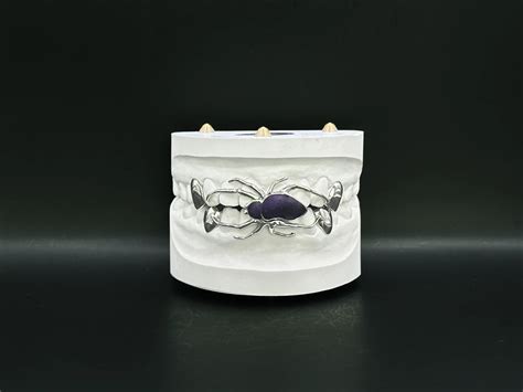 Spider Grillz Custom Grillzgermany Shop