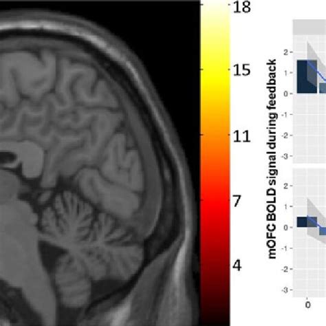 Results Of The Whole Brain Voxelwise Mixed Model Of The Reward Feedback