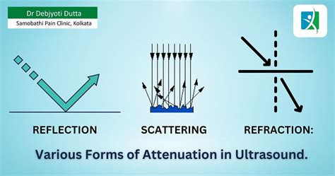 Usg Basics Part 4 Echoes In Tissues Understanding Ultrasound Propagation