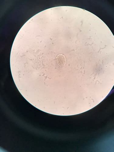 Microbio Lab Practical 2 Flashcards Quizlet