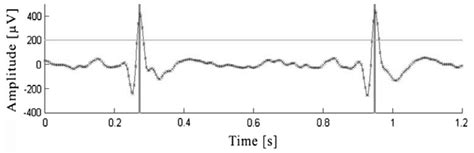 4 rr interval detection from kaufmann et al 2011 the r peaks