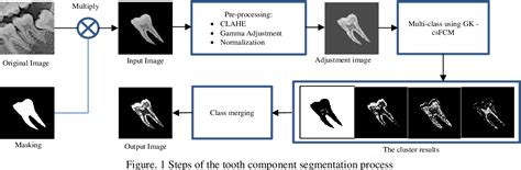 Figure 1 From Segmenting Tooth Components In Dental X Ray Images Using Gaussian Kernel Based