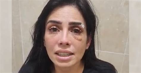 ¡teme Por Su Vida Mujer Salvajemente Golpeada Y Violada En Valencia