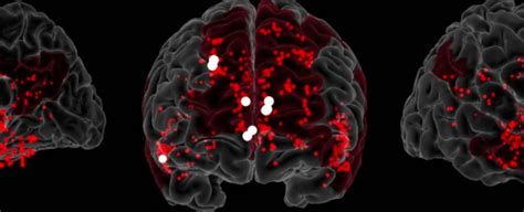 Scientists Identify Neural Network Vital For Creativity In The Brain Sciencealert