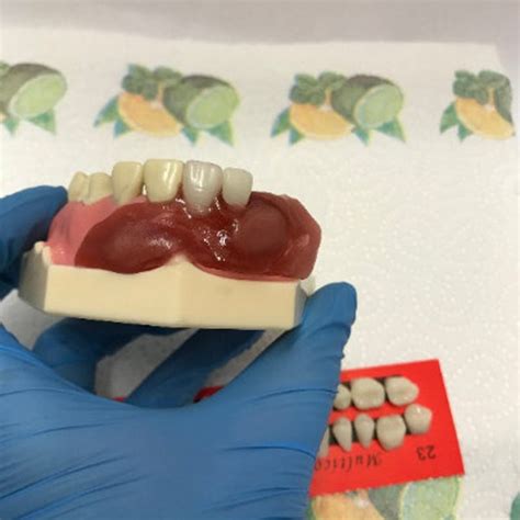 Diy Denture Kit Etsy