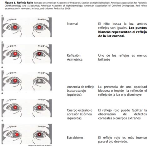 DetecciÓn De Alteraciones Visuales Quizlet