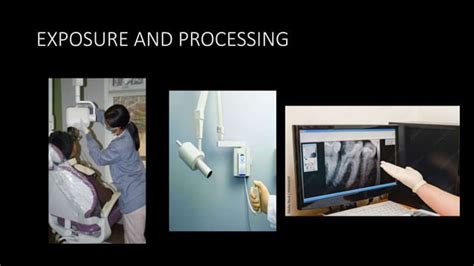 Dental Radiology Bitewing Radiography Copypptx