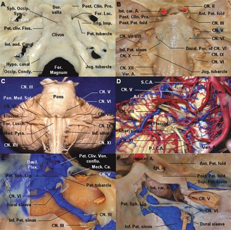 Abducens Nerve The Neurosurgical Atlas