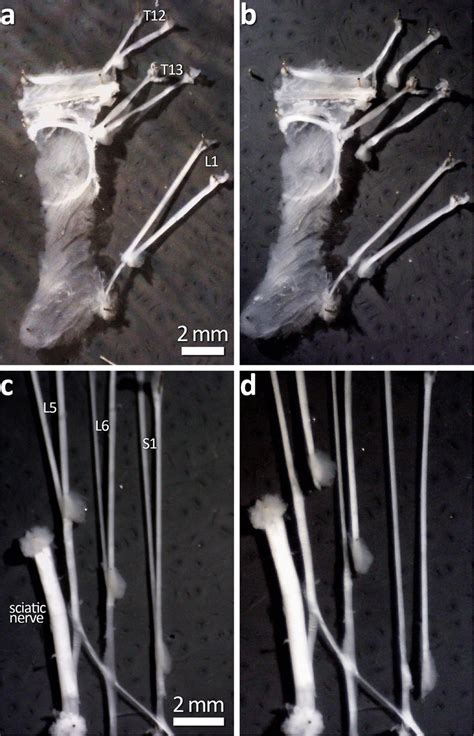 Ex Vivo Demonstration Of Dorsal Root Section Prior To DRG Removal A B Download Scientific