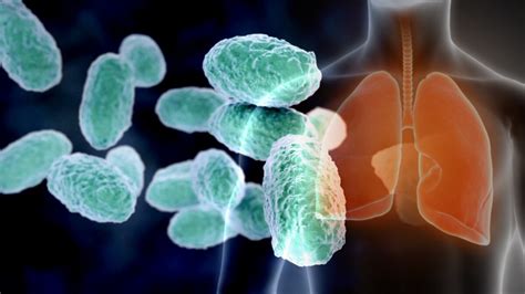 Нови случаи на голема кашлица најголем дел од заразените од Скопје