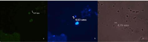 Cryptosporidium Spp Oocyst Visualized In A Tw Sample From Wtp 172 Download Scientific