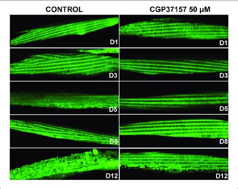 Effect Of Cgp37157 On The Sarcomeric Structure In C Elegans Body Download Scientific Diagram