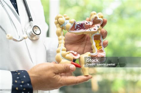장 맹장 및 소화 시스템 병원에서 연구 진단 및 치료를 위한 해부학 모델을 들고 있는 의사 간 내부 기관에 대한 스톡 사진 및 기타 이미지 Istock