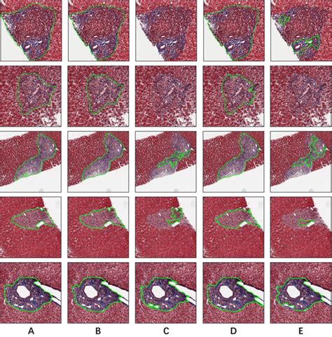 Qualitative Comparison Of Deep Learning Models For Abnormal Liver Download Scientific Diagram