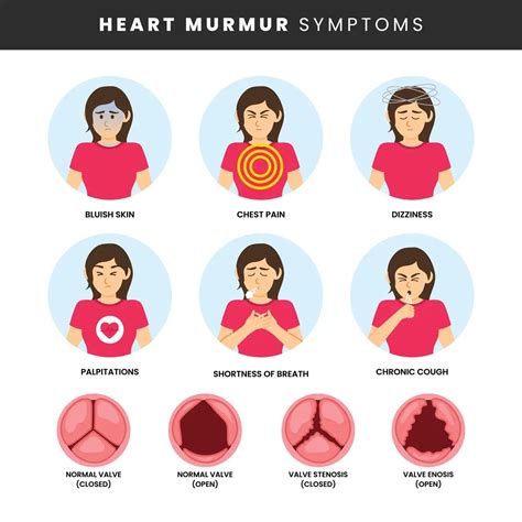 Infective Endocarditis Signs And Symptoms Lightning Learning