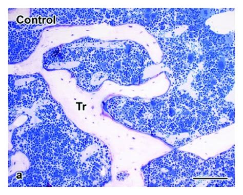 Microstructure Of Cancellous Bone In Mineralized Semi Thin Sections Download Scientific