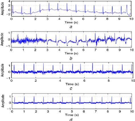 Figure 1 From Detection And Classification Of Ecg Noises Using