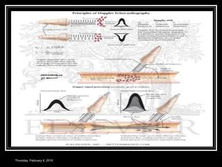 Cardiac Output 1 PPT Heart And Cardiovascular Diseases Diseases And Conditions