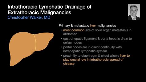 Society Of Thoracic Radiology On Twitter Dr Christopher Walker Discusses · Imaging Clues For