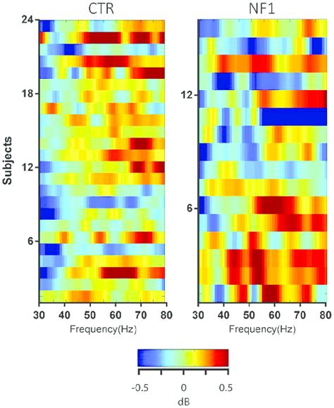 Single Subject Analysis Of Gamma Power Average Power Values For Gamma Download Scientific