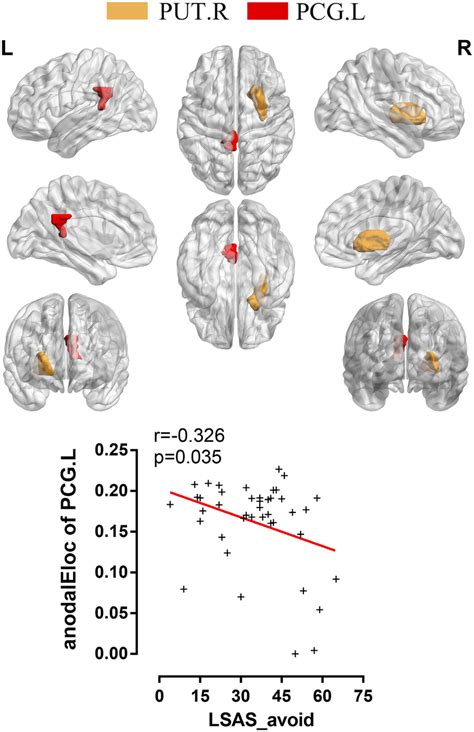 Altered Regional Brain Topological Parameters In The Sad The Colored