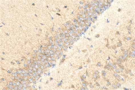 Cleaved Caspase 3 Antibody 25128 1 Ap Proteintech