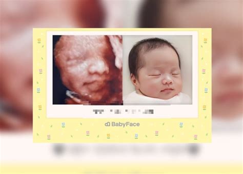 입체초음파 시기13주21주24주29주차 입체초음파 얼굴보는 꿀팁 베이비페이스 비용 네이버 블로그