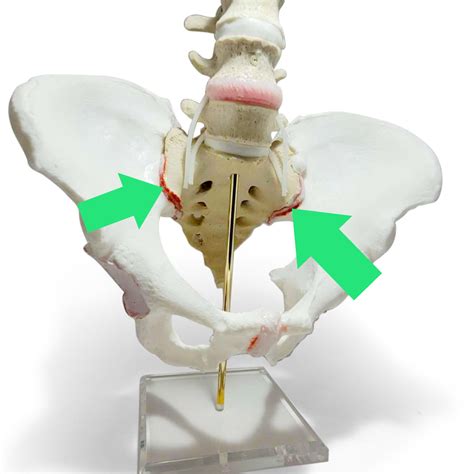 Sacroiliac Joint Dysfunction Chondrocyte Clustering And Fibrillation