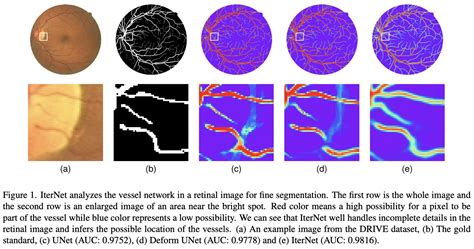 Iternet Retinal Image Segmentation Utilizing Structural Redundancy In Vessel Networks