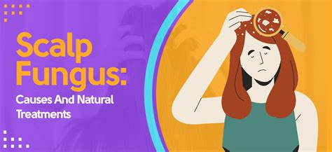 What Causes Fungus To Grow On Scalp At Eden Disney Blog