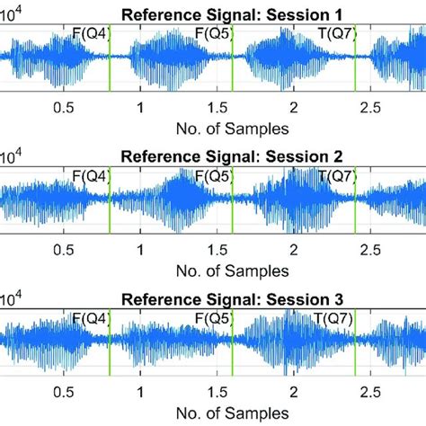 Reference Speech Signals Download Scientific Diagram