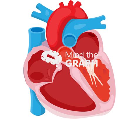 Free Mitral Valve Stenosis Icons Symbols Pictures And Images Mind The Graph