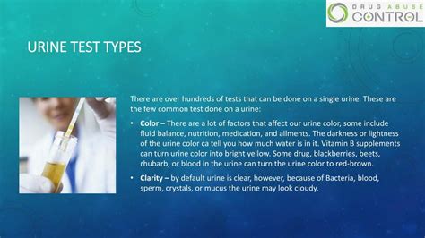 Ppt The Fundamentals Of Urine Testing Powerpoint Presentation Free