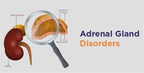 Hormonal Disorders In Men And Women Cause Symptoms And Treatment