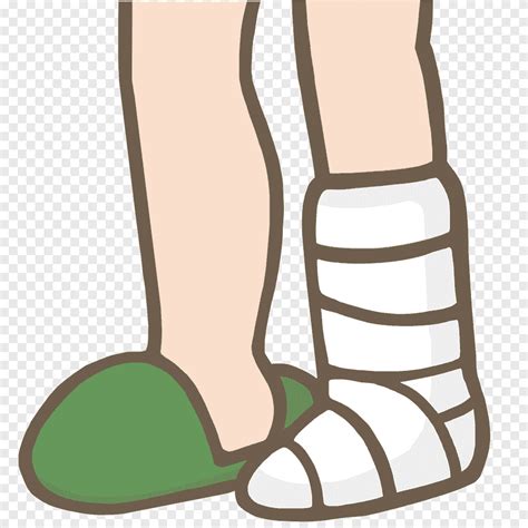 정형 외과 캐스트 인간의 다리 붕대 버팀목 골절 손 손 사진술 Png Pngegg