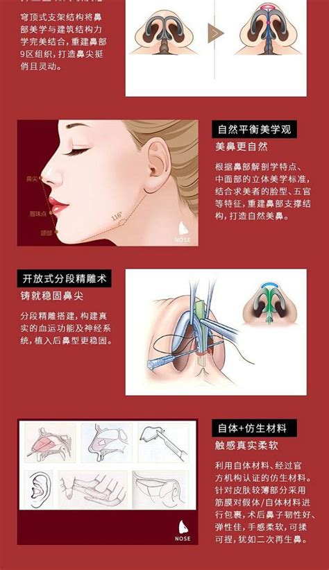 鼻综合整形鼻部美学 自然仿生美弧鼻两项；膨体耳软骨 硅胶膨体肋软骨非鼻修复悦美整形