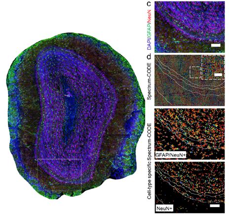 Spatial Transcriptomics 深圳市安瑞生物科技有限公司