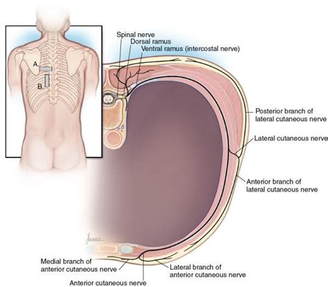 Paravertebral Block Clinical Tree