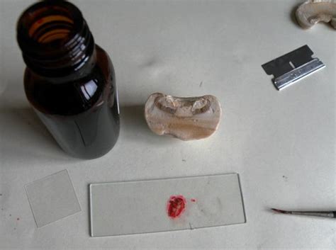 Microscopy Of Spores Hyphae Cystidia Trama To Identify Fungi