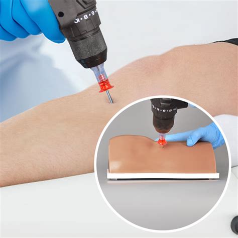 Tibia Intraosseous Io Trainer With Detachable Inner Bone