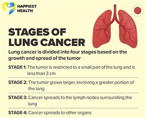 Stage 1 Of Lung Cancer