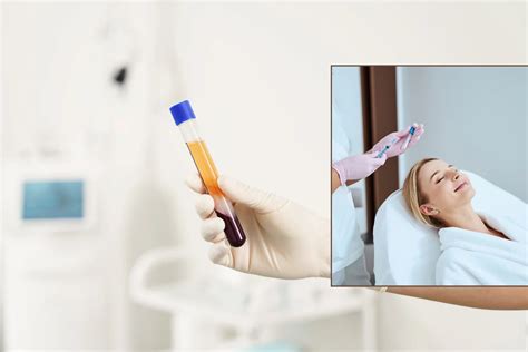 Platelet Rich Fibrin Prf Therapy Madhuram Ozone Skin And Laser Center