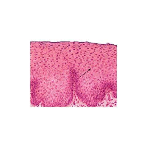 Ks 15 Stratified Squamous Epithelium Secretary Buy Prepared Slides